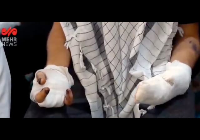 Video Shows Hezbollah Terrorists Injured by Pagers, Walkie-Talkies in Iran